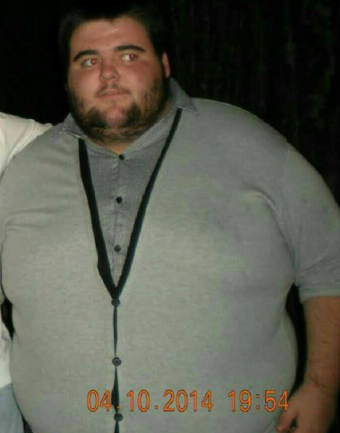 Dylan Condron lost 19.5 stone and beat obesity but now he needs your ...